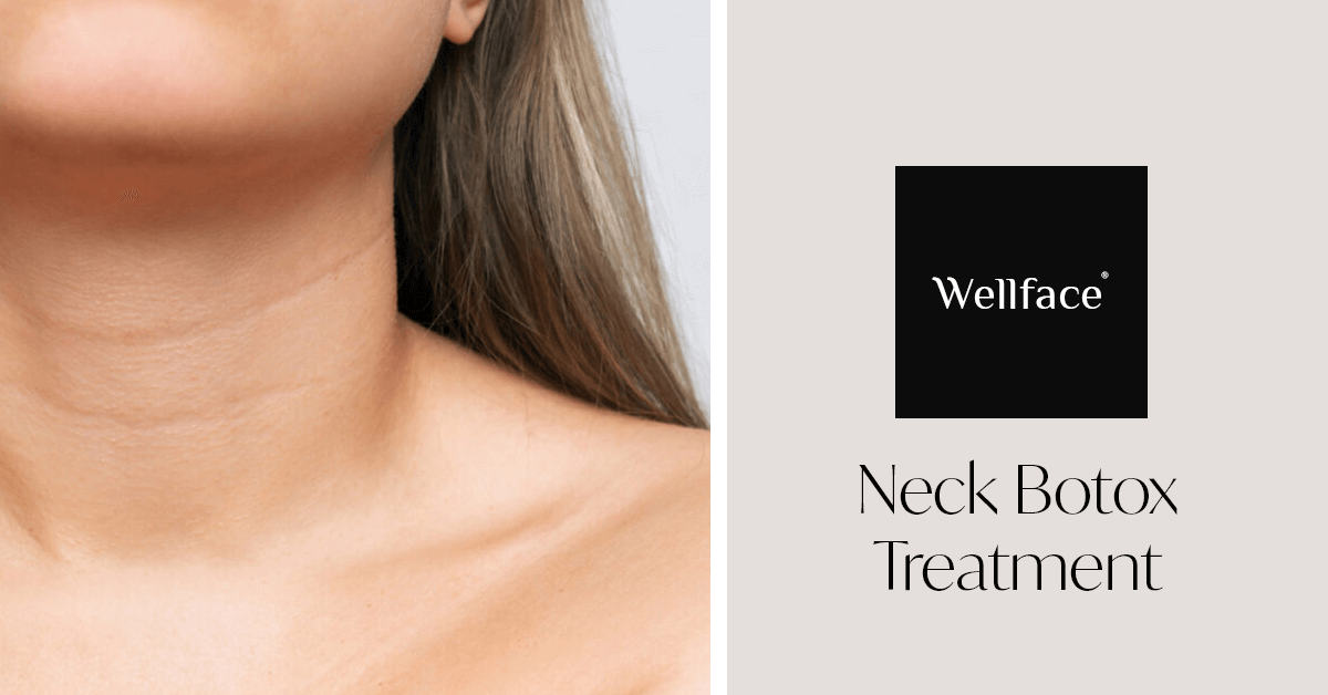Neck Botox Treatment in Surrey - Wellface®