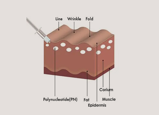 Polynucleotides in Surrey by Dr Yasmin Tayeb - Wellface®