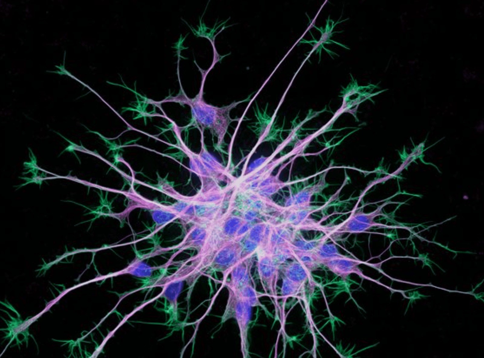 Samphire Neuroscience